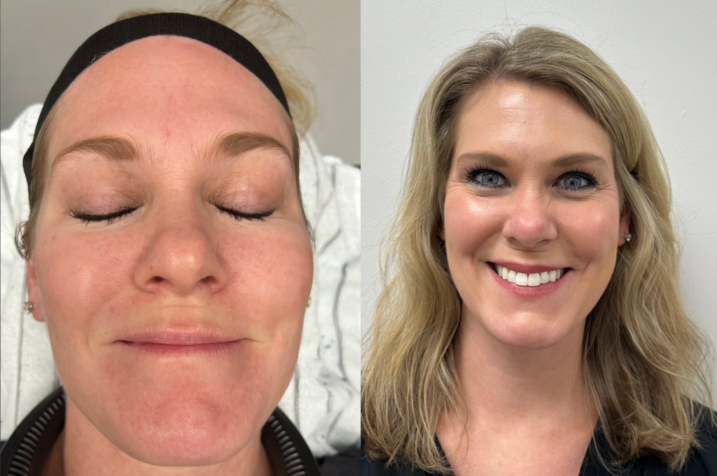 Before & After Gallery Jackson MS, Aligned Oral and Facial Surgery